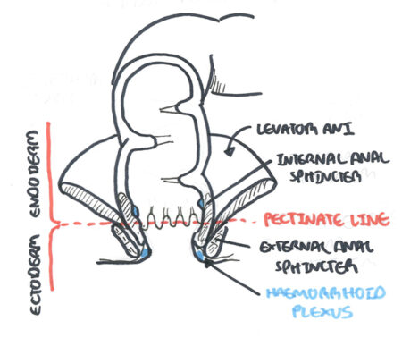 Fistula-In-Ano - Armando Hasudungan