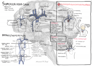 SVC anatomy and obstruction Armando Hasudungan