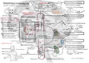 Thrombocytopaenia Overview - Personal Use - Armando Hasudungan