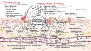 Understanding Inflammation - the Inflammatory response Armando Hasudungan