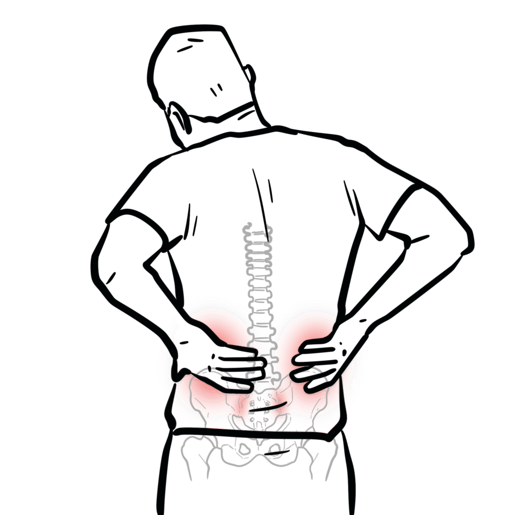 Caplan Syndrome - Armando Hasudungan