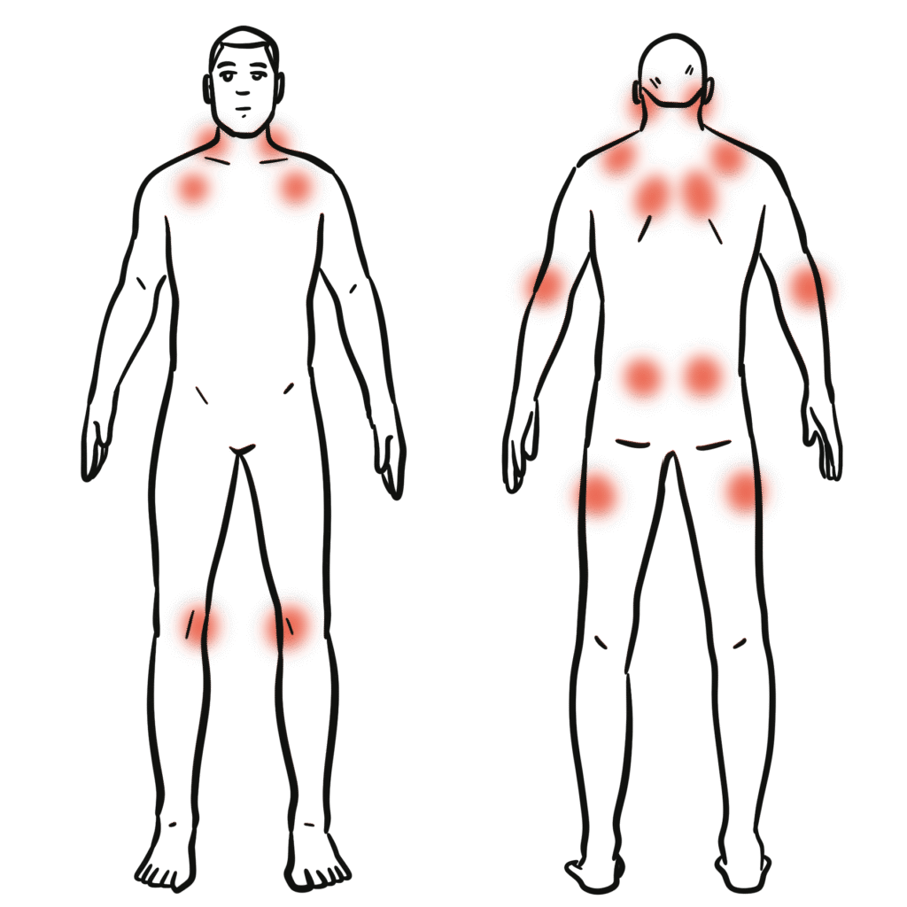 Undifferentiated Connective Tissue Disease (UCTD) Armando Hasudungan