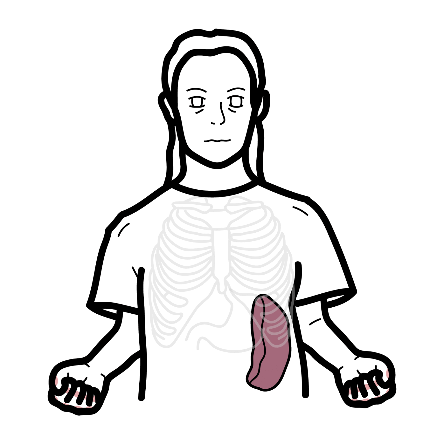 Rheumatoid Arthritis Armando Hasudungan