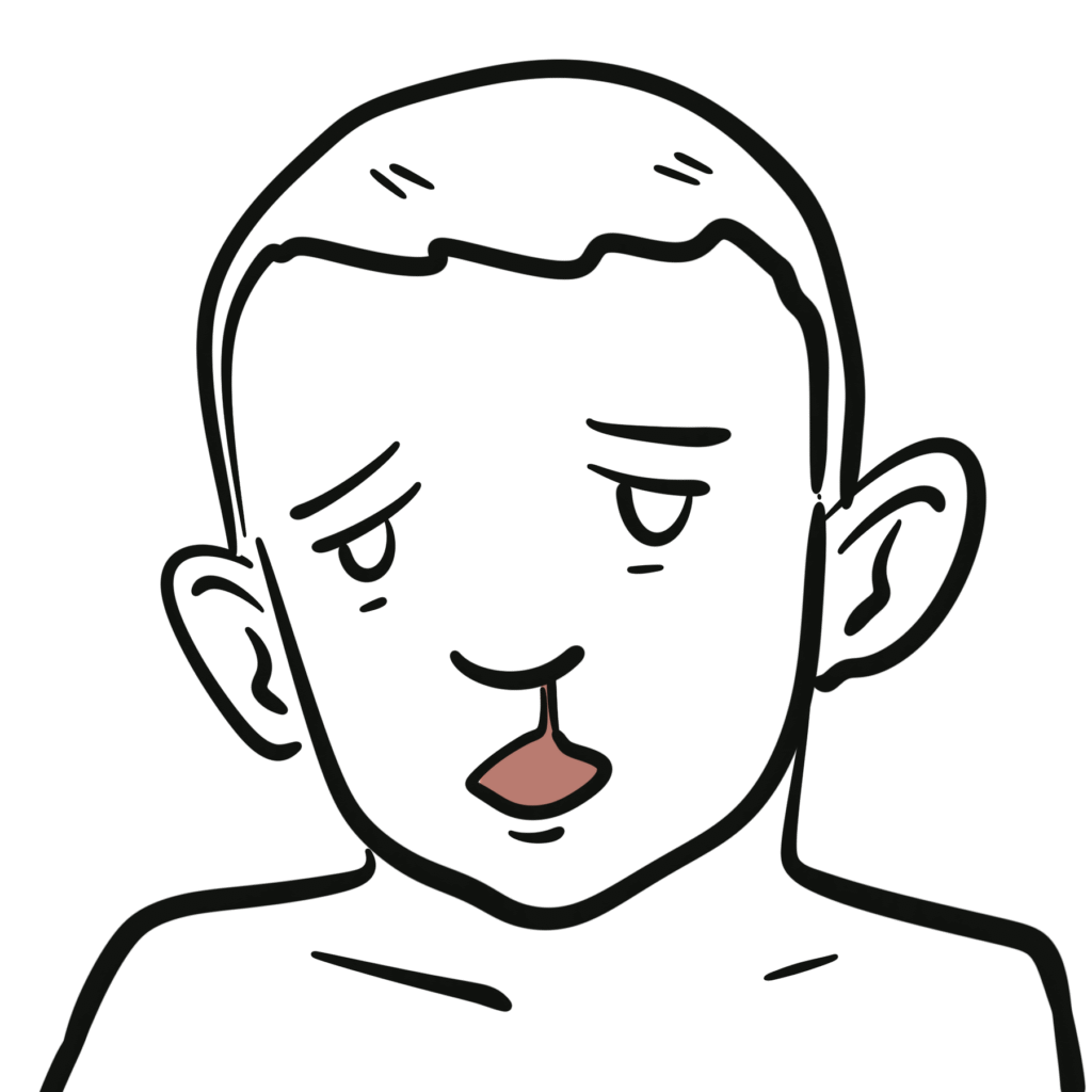 Hyper-IgE Syndrome (Job’s Syndrome) Armando Hasudungan