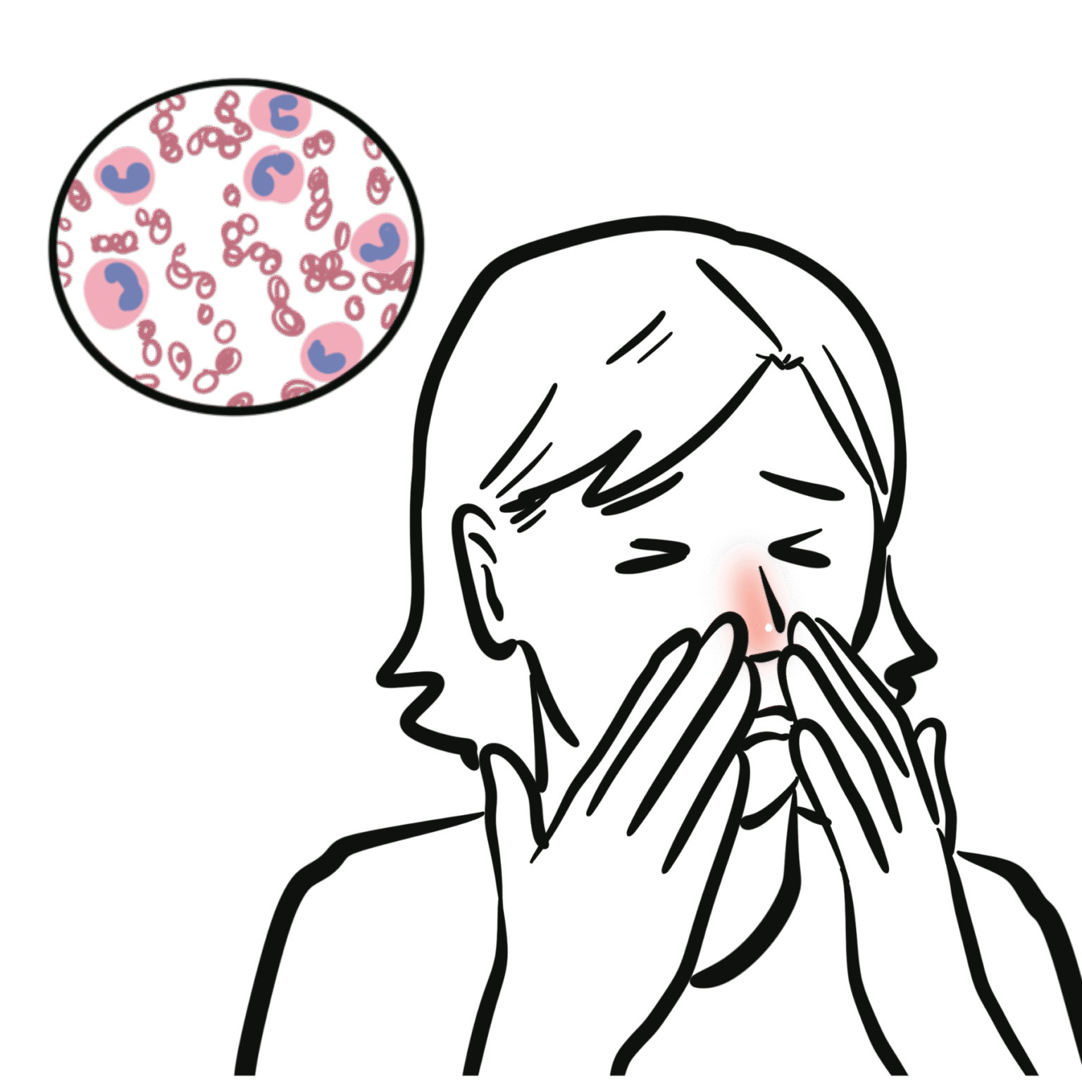 Basic Calcium Phosphate Disease / Milwaukee Shoulder Syndrome Armando ...