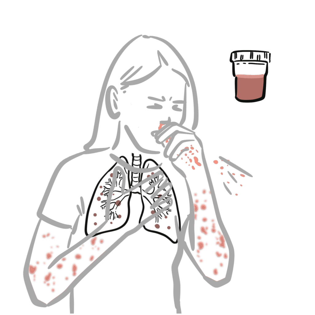 Undifferentiated Connective Tissue Disease (UCTD) Armando Hasudungan