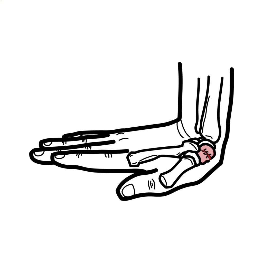 PAIN! Physiology - The Ascending Pathway, Descending Pain Pathway and ...