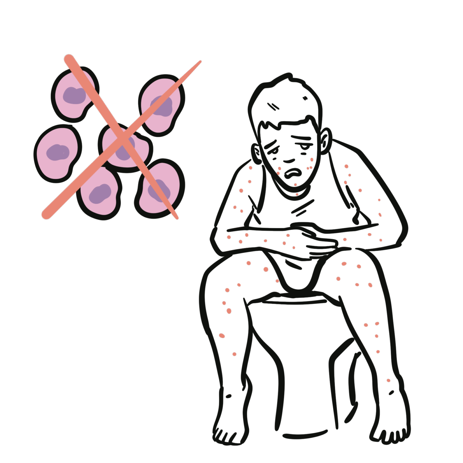 Hyper-IgE Syndrome (Job’s Syndrome) Armando Hasudungan