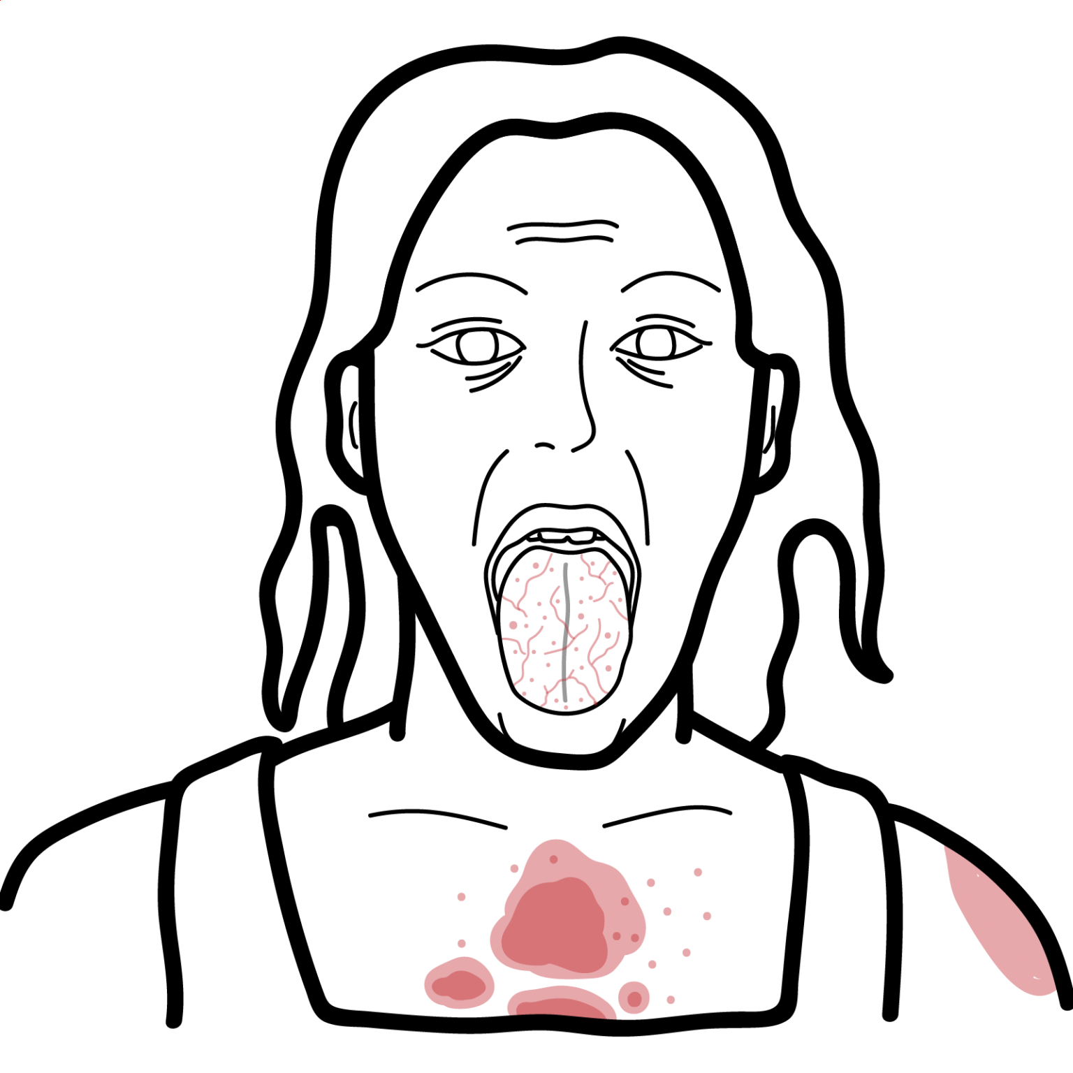 Undifferentiated Connective Tissue Disease (UCTD) Armando Hasudungan