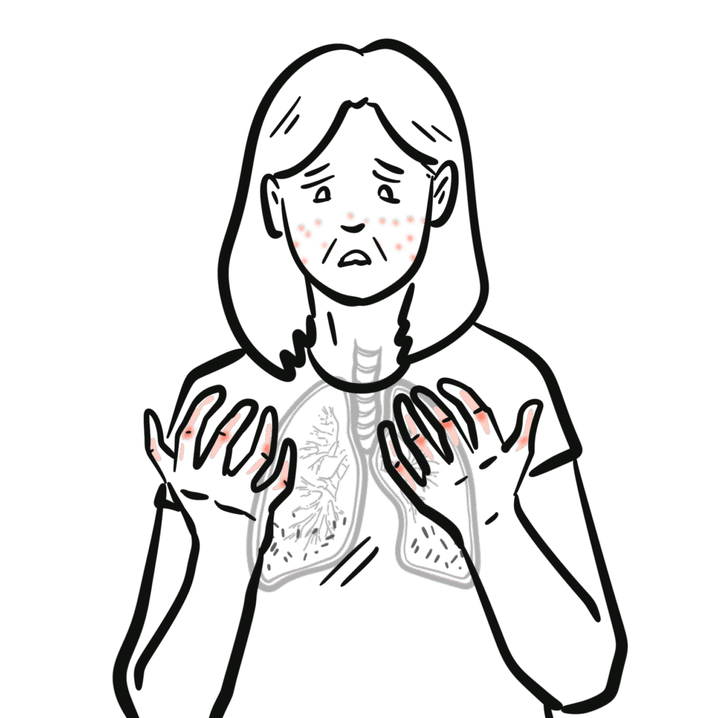 Undifferentiated Connective Tissue Disease (UCTD) Armando Hasudungan