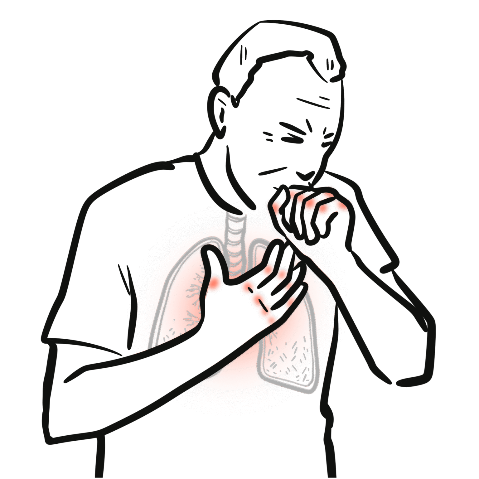 Undifferentiated Connective Tissue Disease (UCTD) Armando Hasudungan