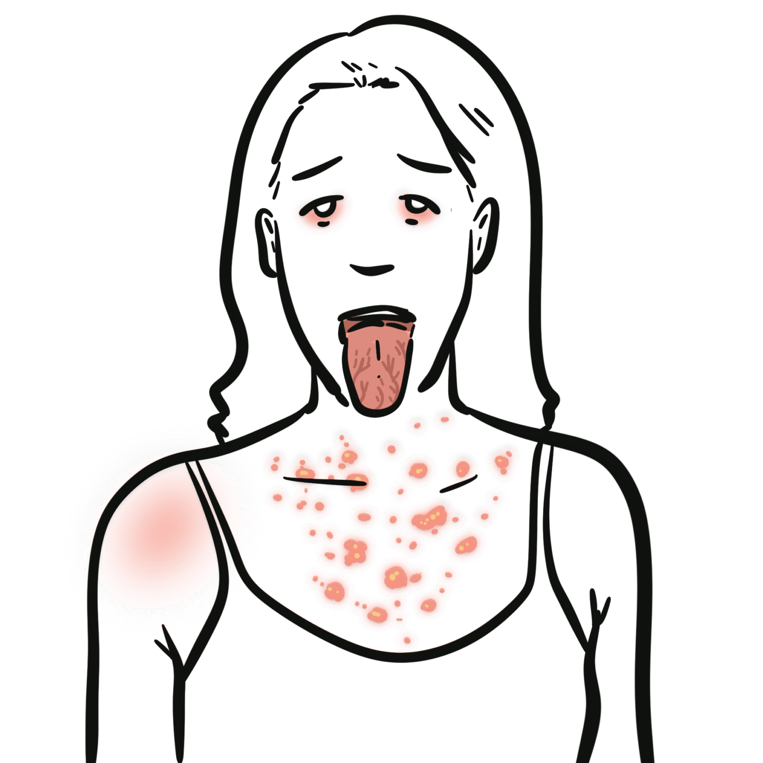 Undifferentiated Connective Tissue Disease (UCTD) Armando Hasudungan