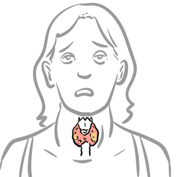 Bilirubin Metabolism - unconjugated and conjugated bilirubin Armando ...